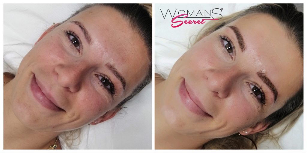 Microblading